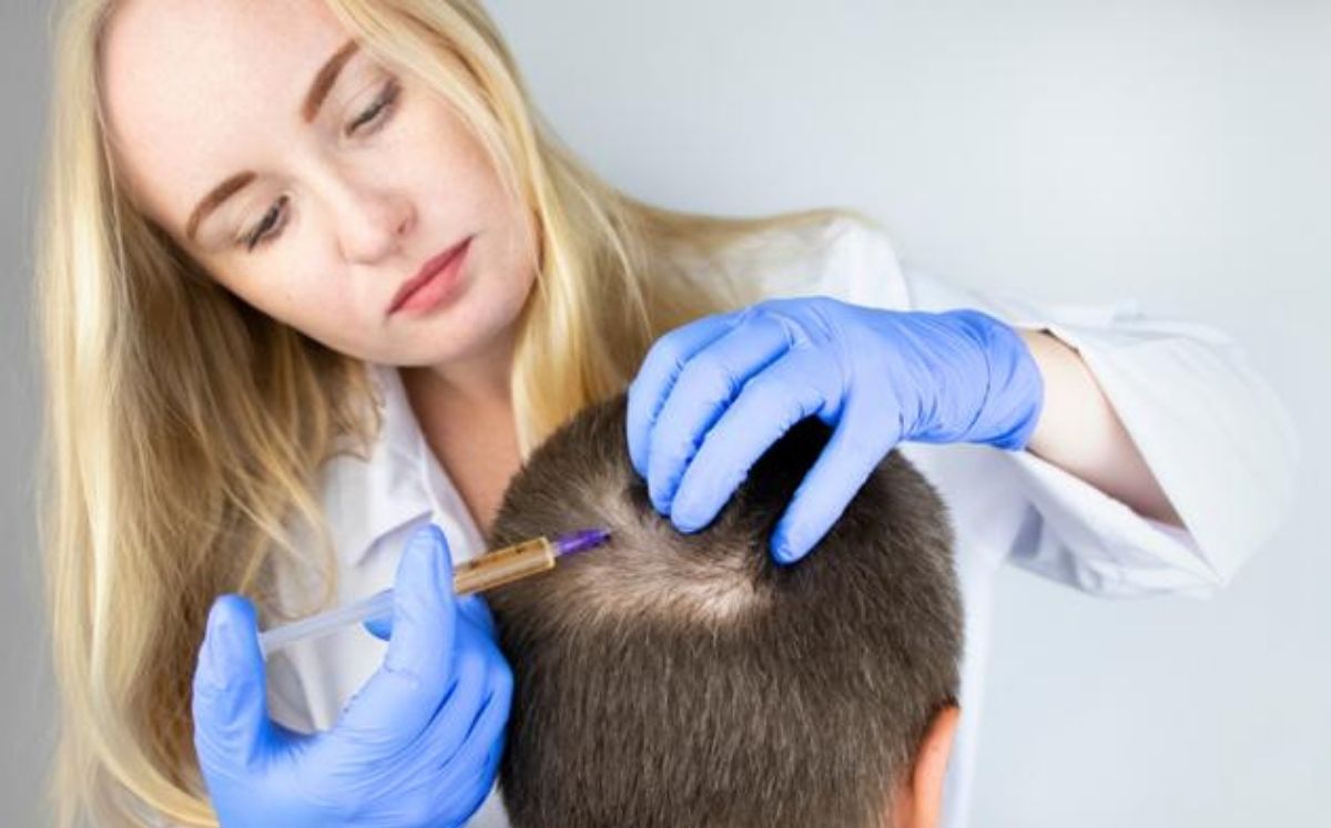 ¿Cuáles son los tratamientos para alopecia? - DermaMedic